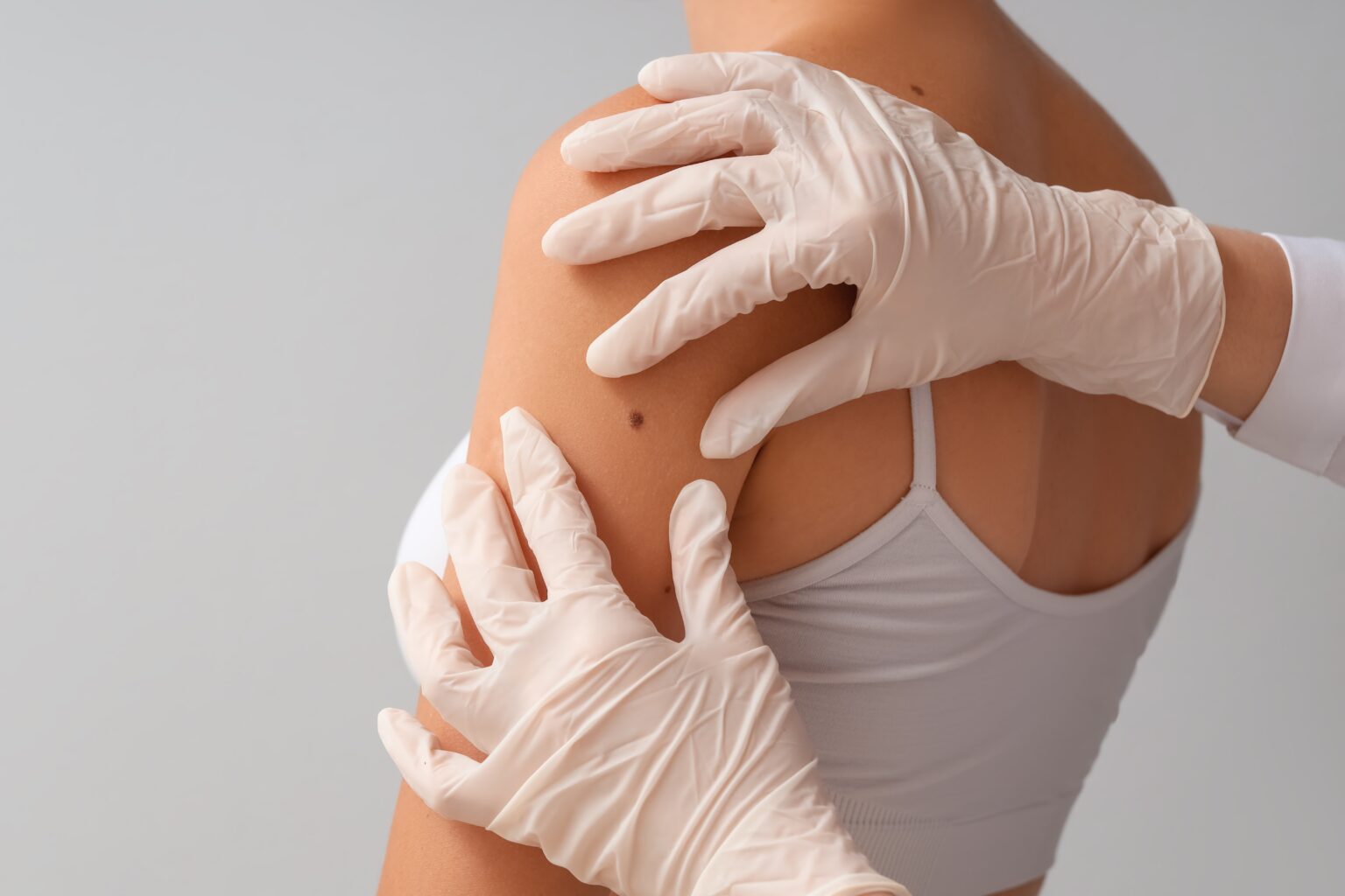 What Does Skin Cancer Look Like Under a Microscope? | Calkin ...