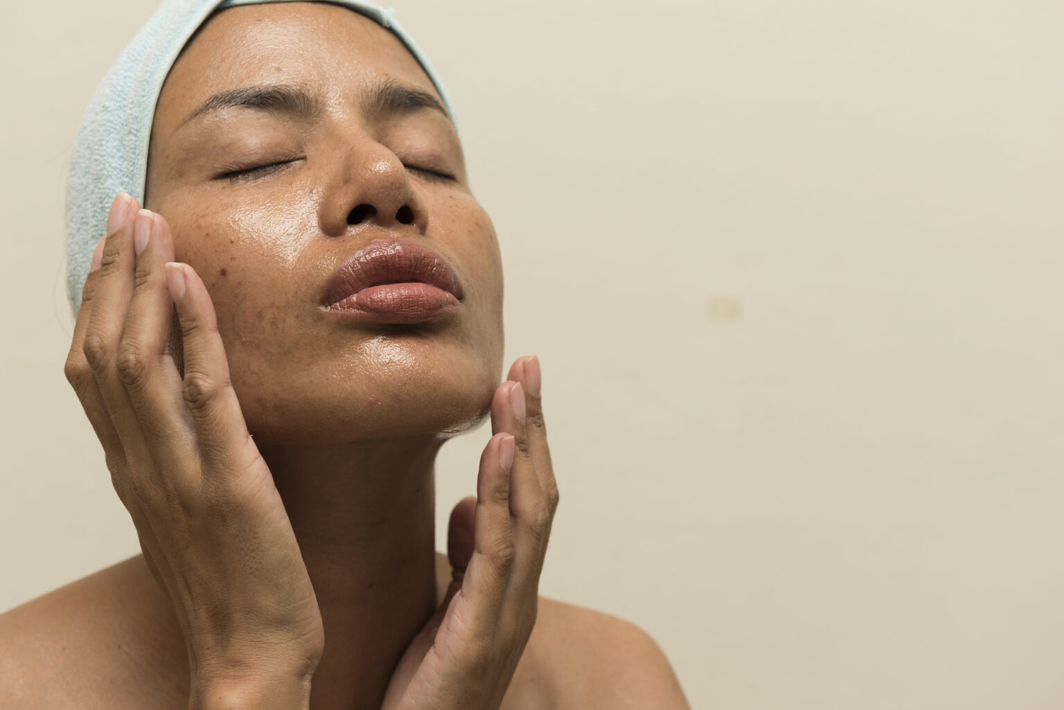 What Is the Connection Between Hormones and Sudden Skin Changes ...