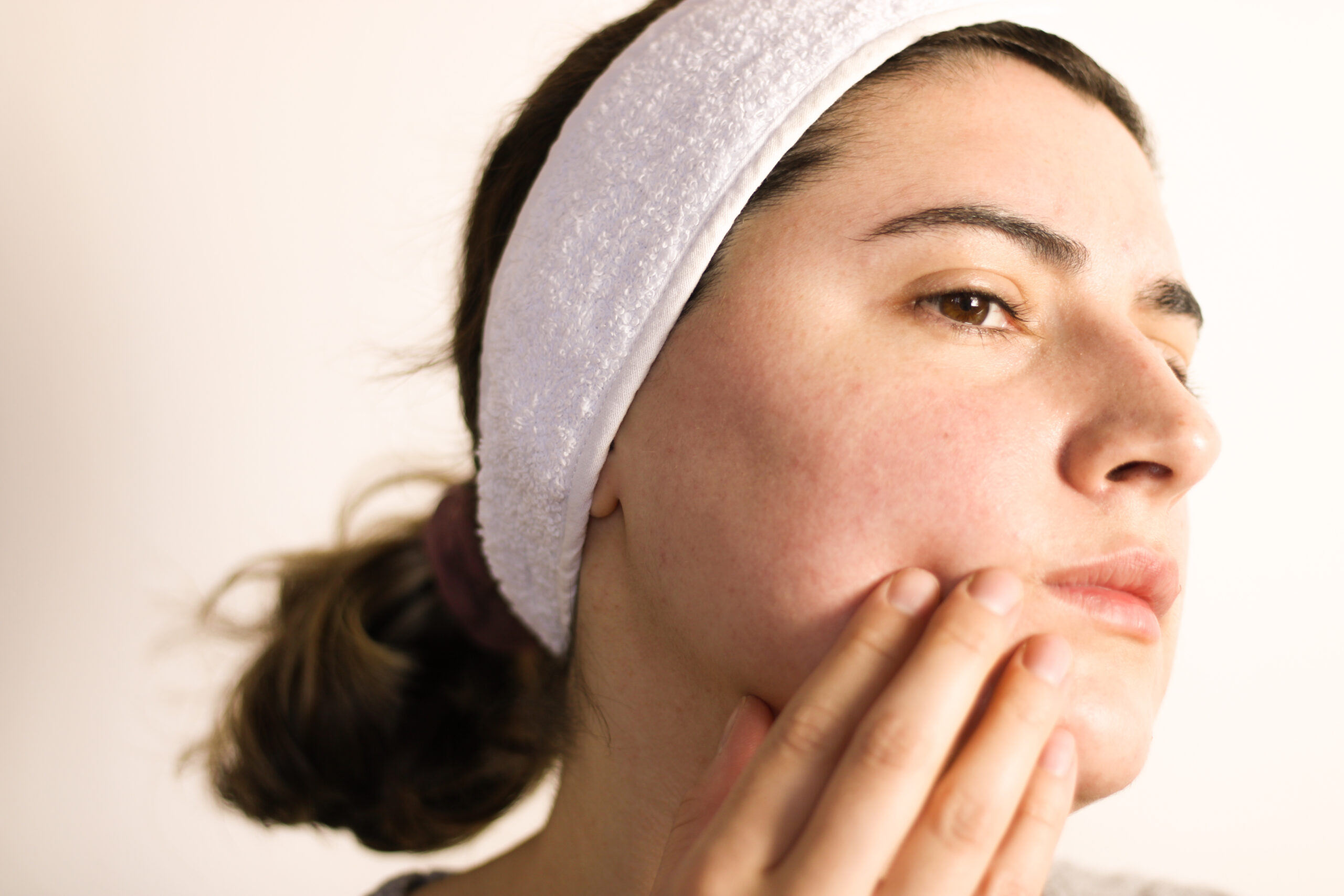 What Is the Difference Between Rosacea and Regular Sensitive Skin ...